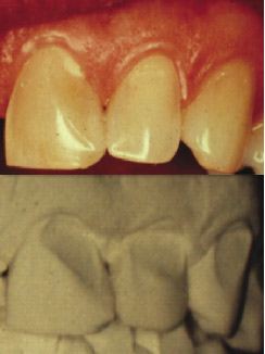 The importance of making and retaining diagnostic casts | Dental Economics