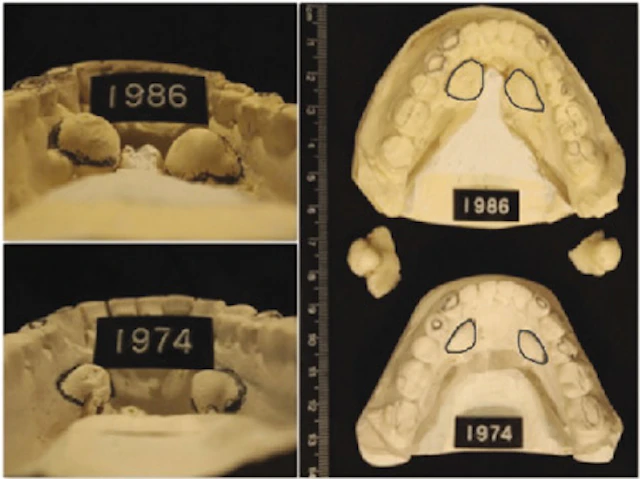 The importance of making and retaining diagnostic casts | Dental Economics