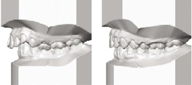 The importance of making and retaining diagnostic casts | Dental Economics