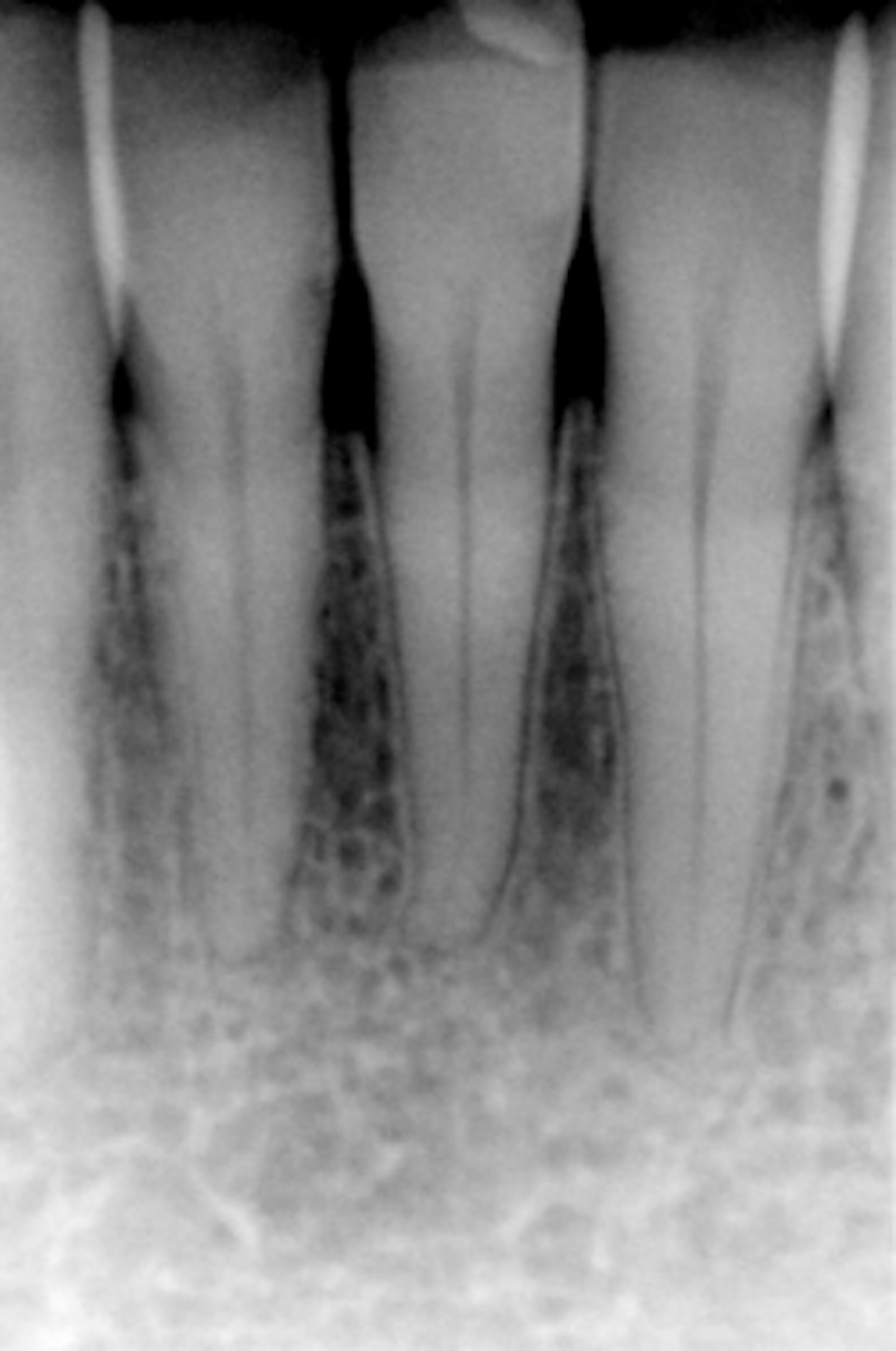 ALARA, rectangular collimation, and profitable practice growth | Dental ...