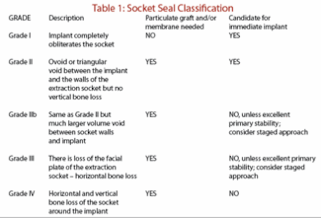 Immediate implant placement and the Socket Seal classification | Dental ...