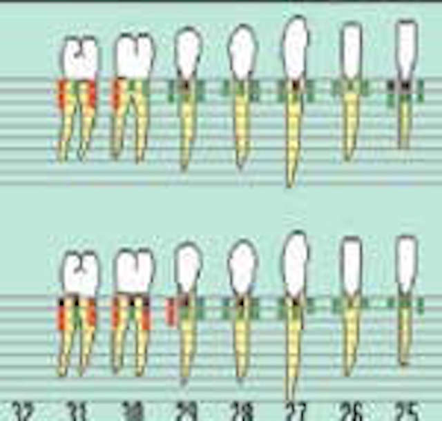 Computerized Charting and the Electronic Health Record in Dentistry ...