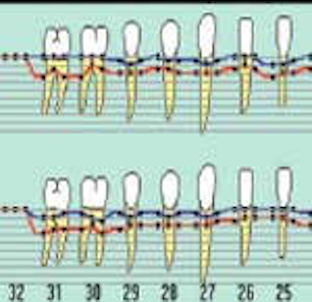Computerized Charting and the Electronic Health Record in Dentistry ...