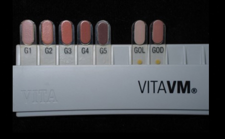 To glaze or not to glaze | Dental Economics