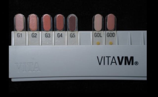 To glaze or not to glaze | Dental Economics