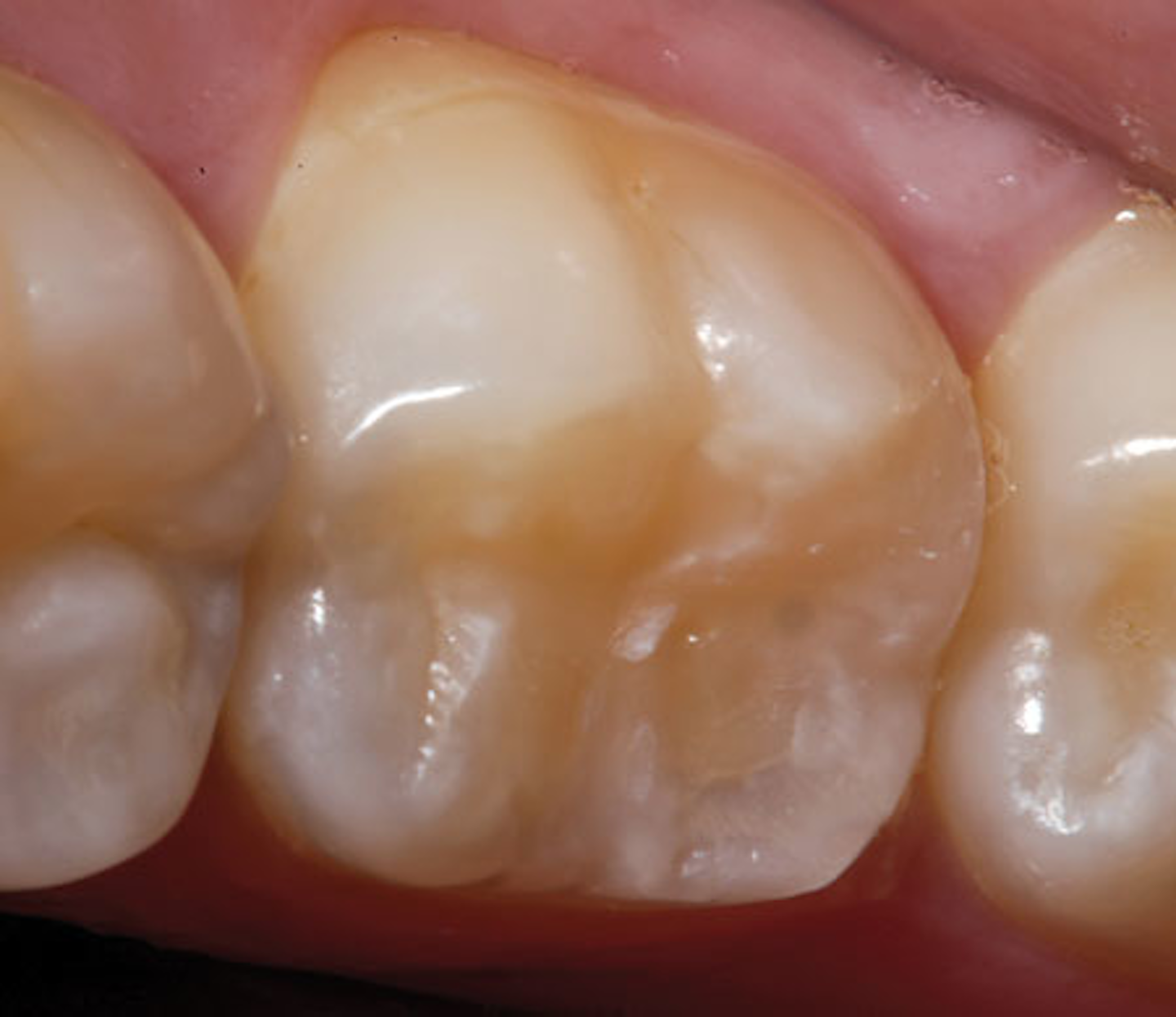 Differentiate yourself: Early diagnosis, minimally invasive cavity ...