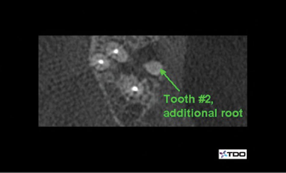 Is cone beam really necessary? | Dental Economics