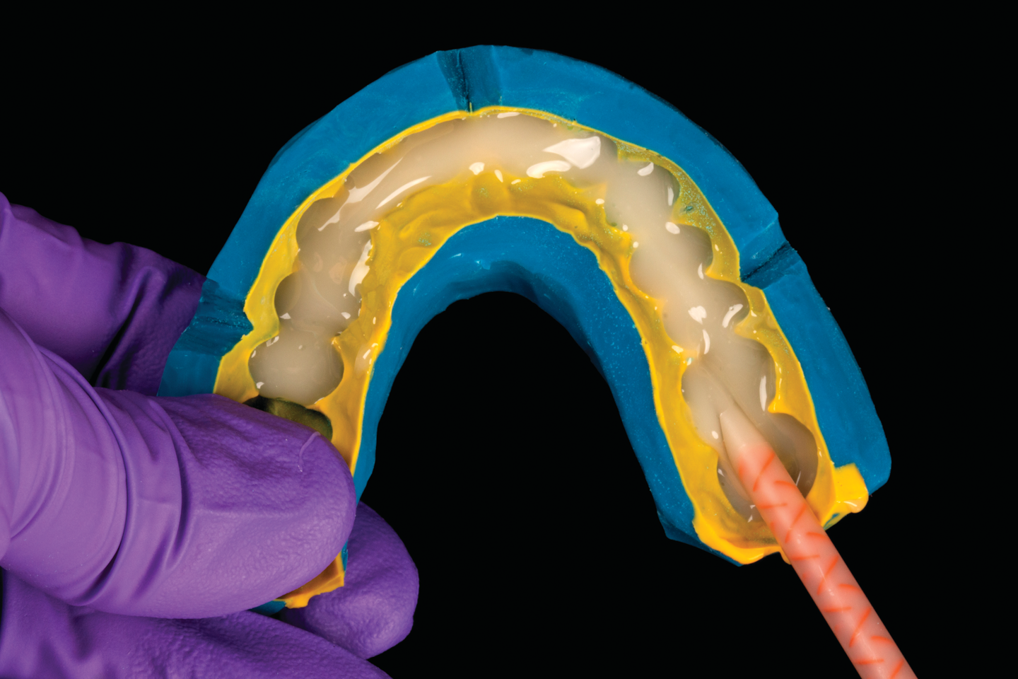 Esthetic And Functional Long Term Prototypes Utilizing High Strength