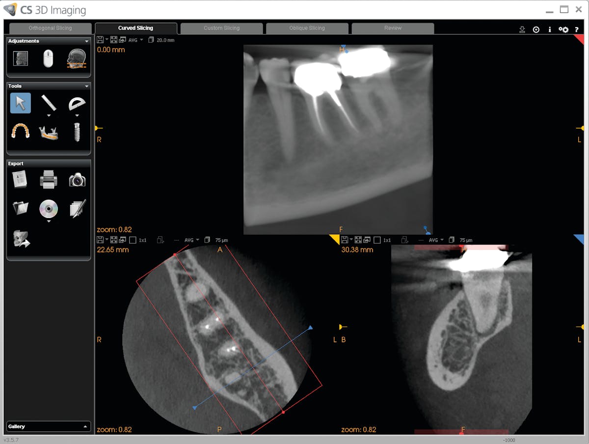 CBCT in the dental practice: Creating efficiencies and value | Dental ...