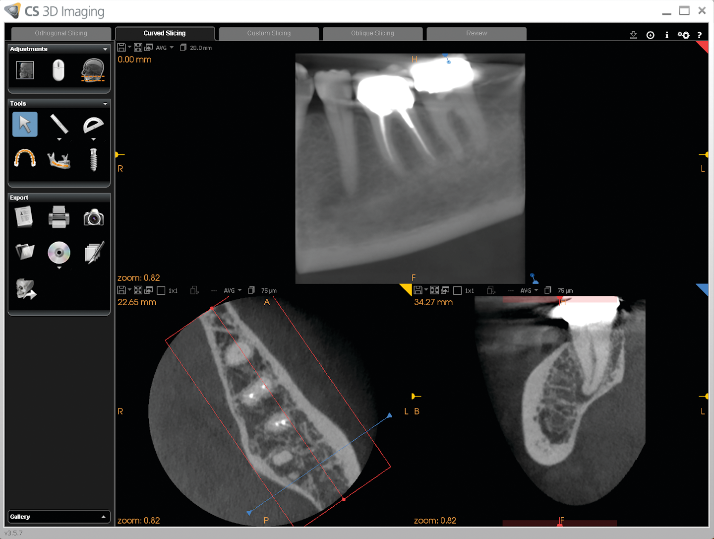 CBCT in the dental practice: Creating efficiencies and value | Dental ...