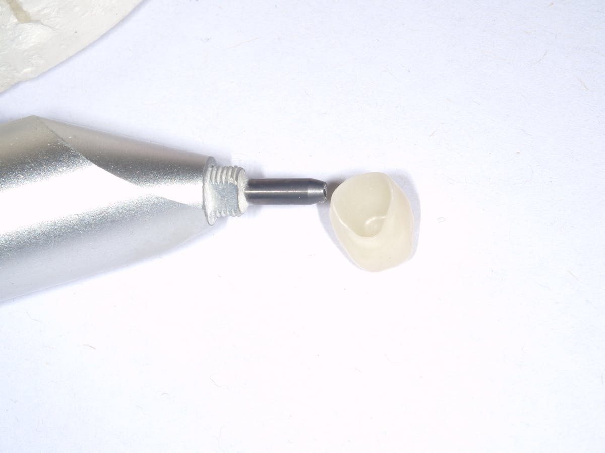 Simplifying cementation with reliability | Dental Economics