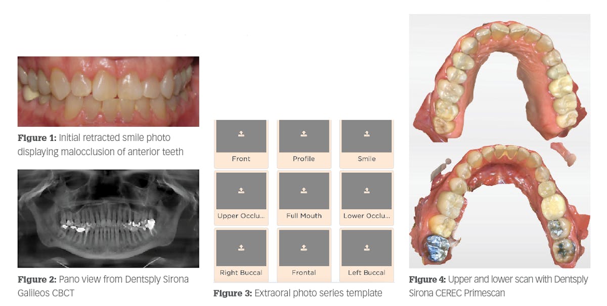 Digital workflow for clear aligner therapy | Dental Economics