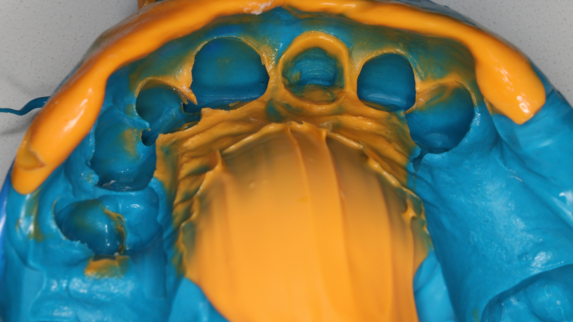 Impression disinfection | Dental Economics