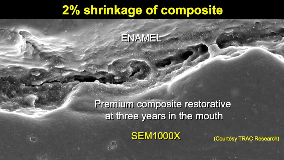 Reducing composite resin failures | Dental Economics