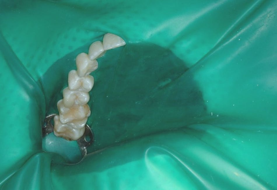 How to make operative dentistry enjoyable, predictable, and productive ...