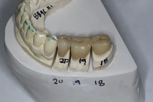 Dental cementation: Evolution to revolution in everyday dentistry ...