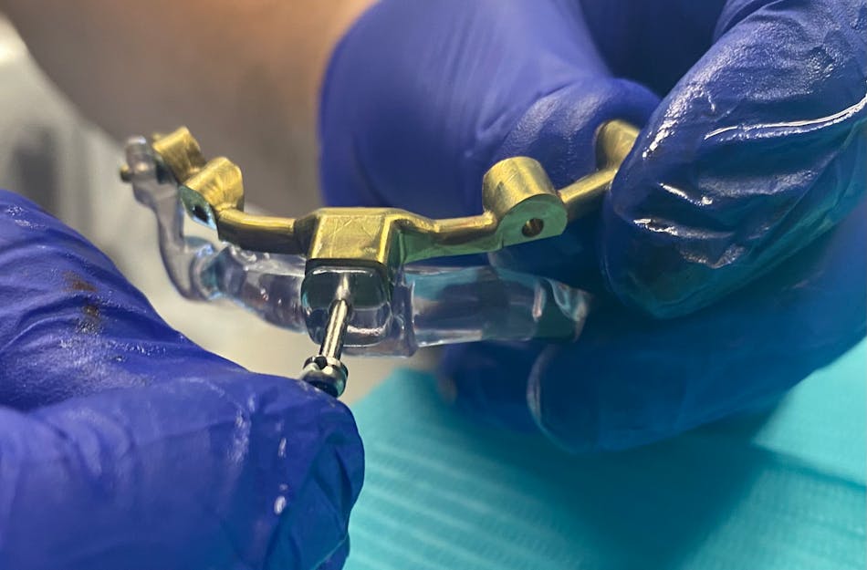 The continued evolution of dental implant surgical guides with material ...