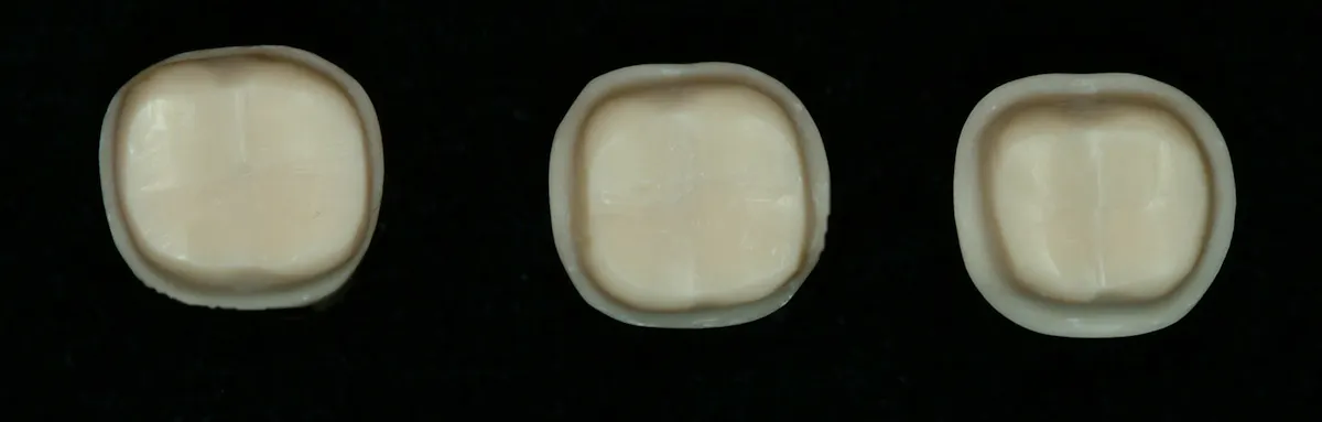 Solving challenges with zirconia and lithium disilicate crowns | Dental ...