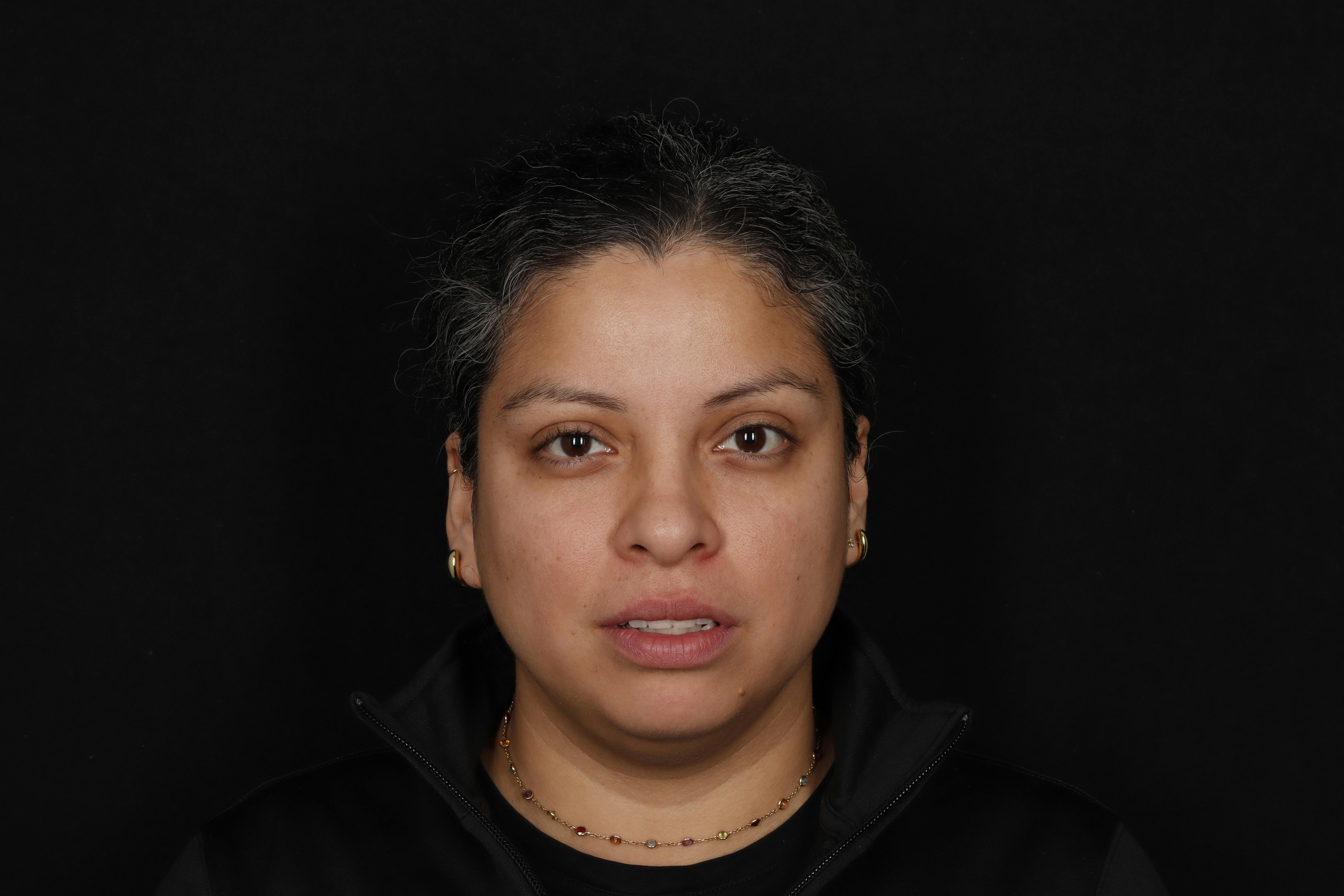 Creating Consistency with Charlie and Chris: Photos for diagnostic ...