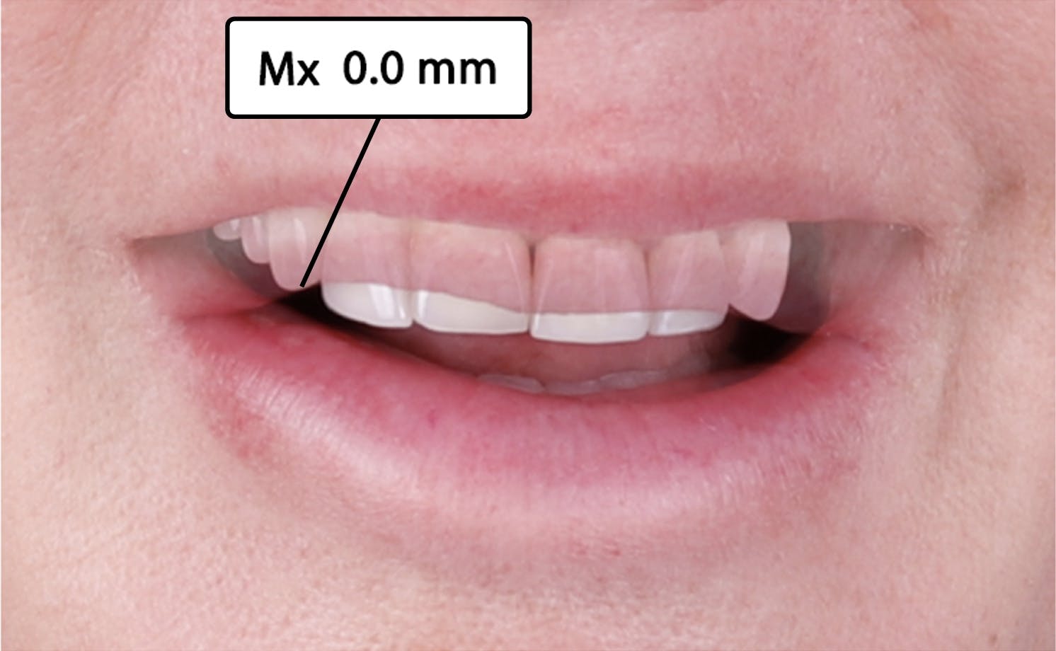 Creating Consistency with Charlie and Chris: The importance of the ...