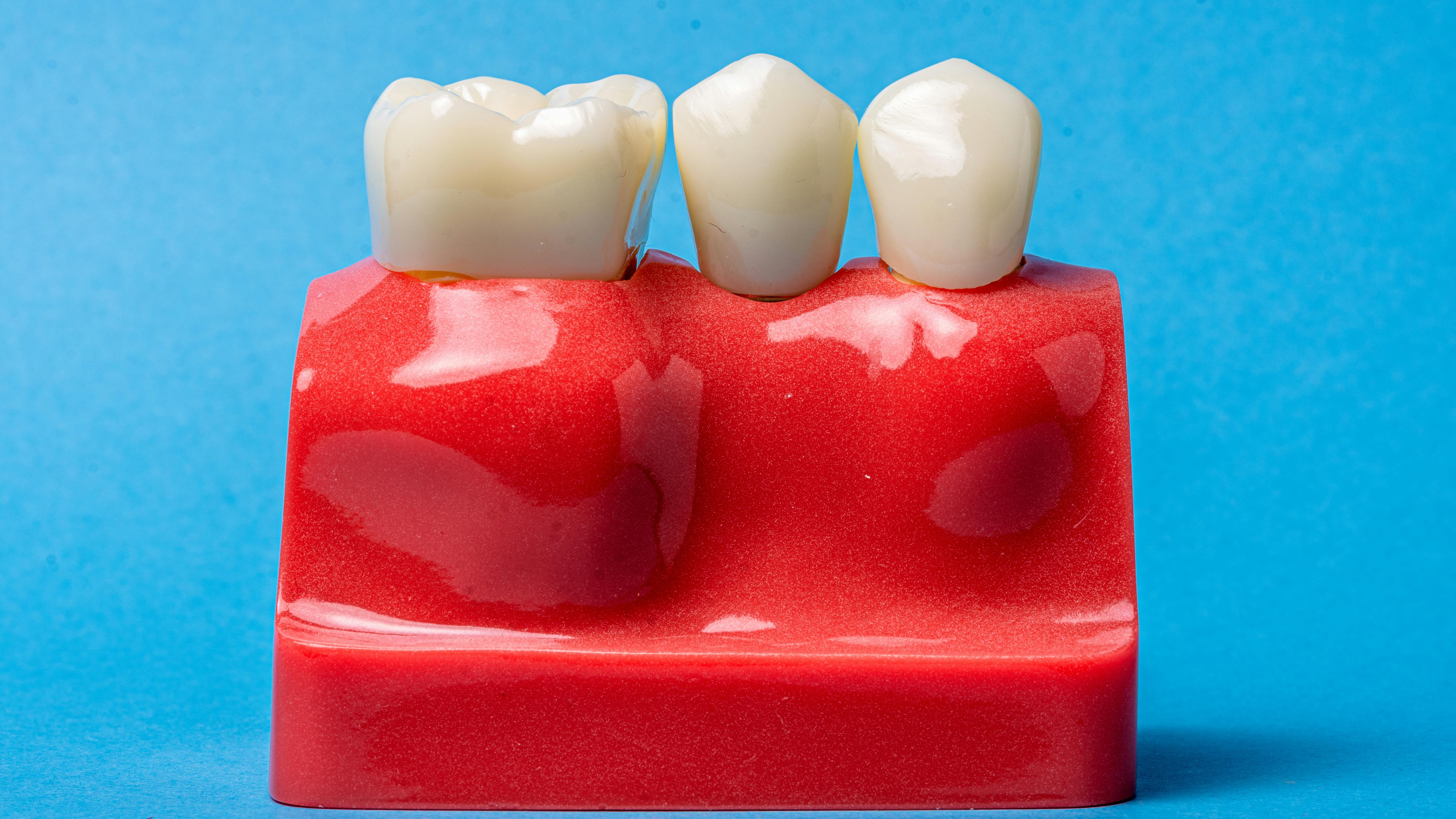 Closing the periodontal treatment gap in general practice | Dental ...